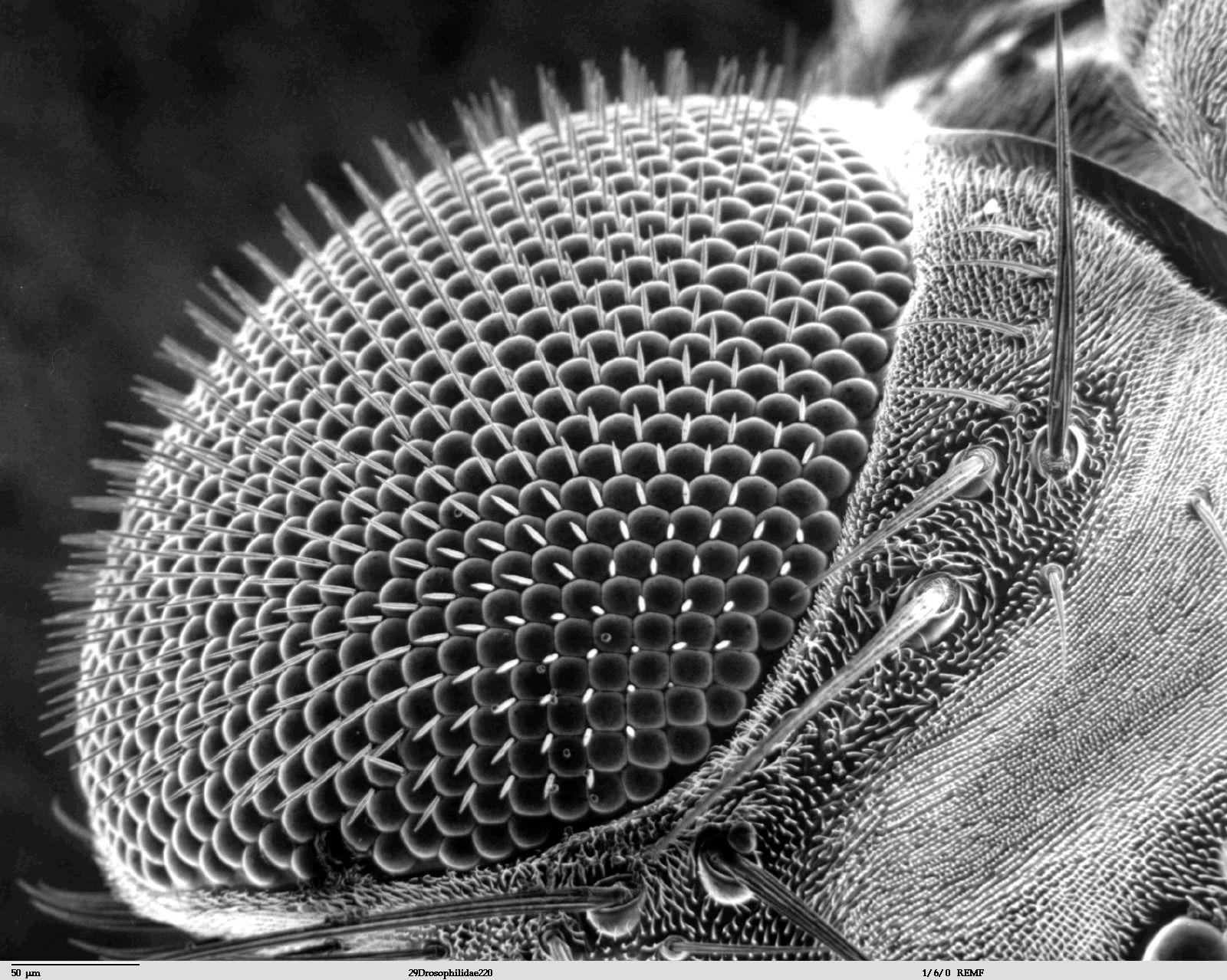 Microscopic Images Of Eyes